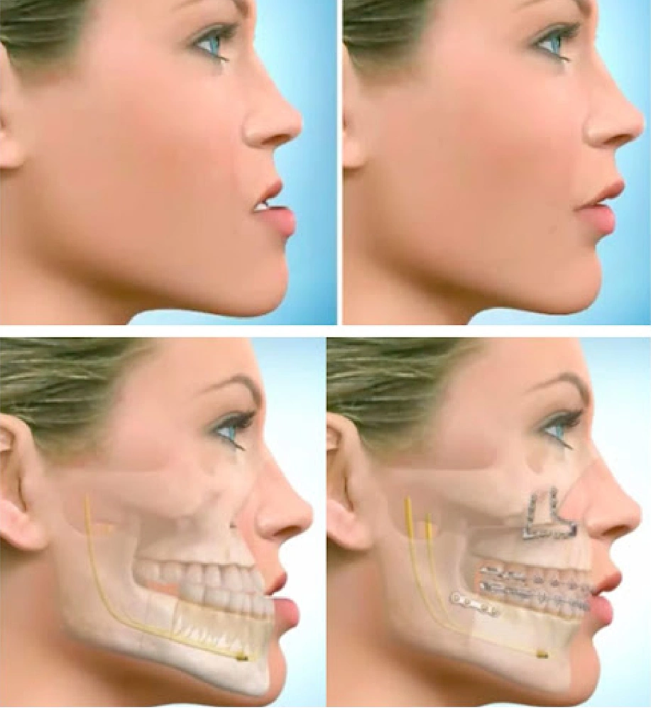 Chirurgia Orale: trattamenti specialistici | Dr. Mortillaro